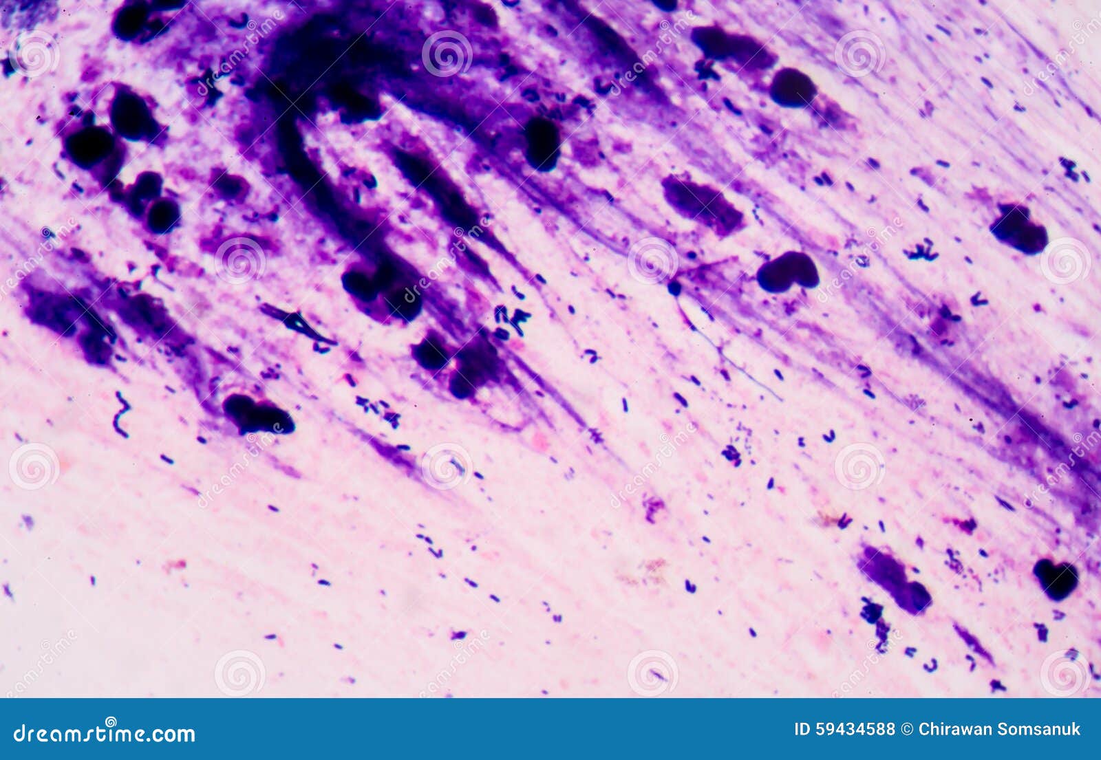 Bacilles Grampositifs Bactéries Photo stock - Image du humain, médecine ...