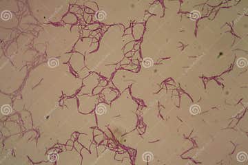 Bacillus Anthracis Anthrax 200x Stock Photo - Image of milzbrand ...