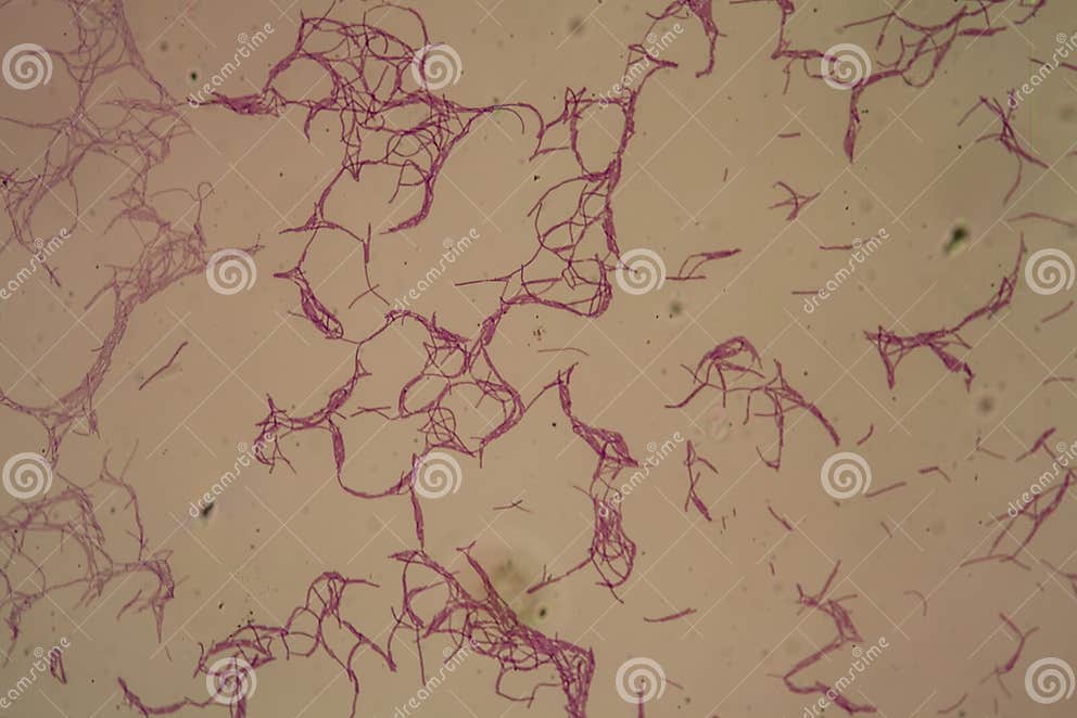 Bacillus Anthracis Anthrax 200x Stock Photo - Image of milzbrand ...