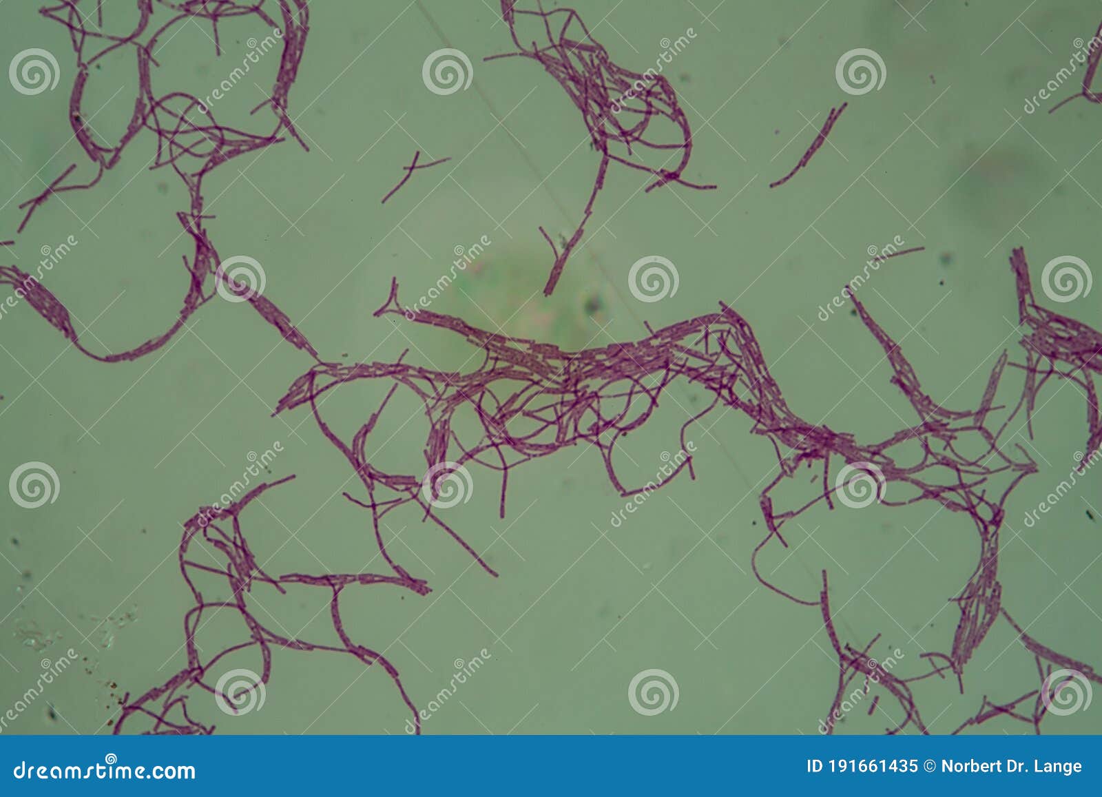 Bacillus Anthracis Anthrax 200x Stock Image - Image of anthrax ...