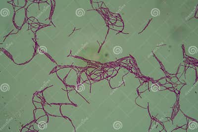 Bacillus Anthracis Anthrax 200x Stock Image - Image of anthrax ...