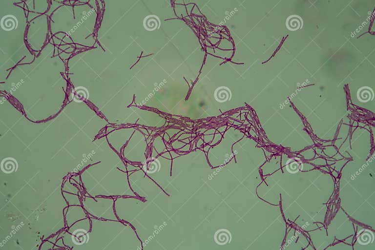 Bacillus Anthracis Anthrax 200x Stock Image - Image of anthrax ...