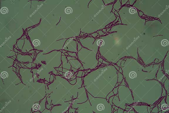 Bacillus Anthracis Anthrax 200x Stock Image - Image of bacillus, germs ...