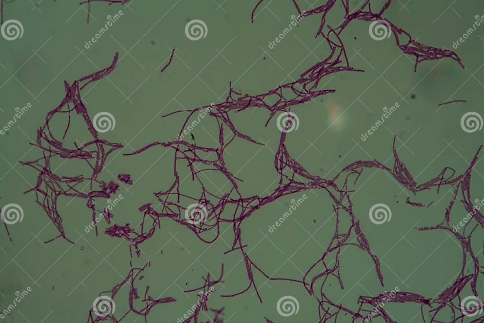 Bacillus Anthracis Anthrax 200x Stock Image - Image of bacillus, germs ...