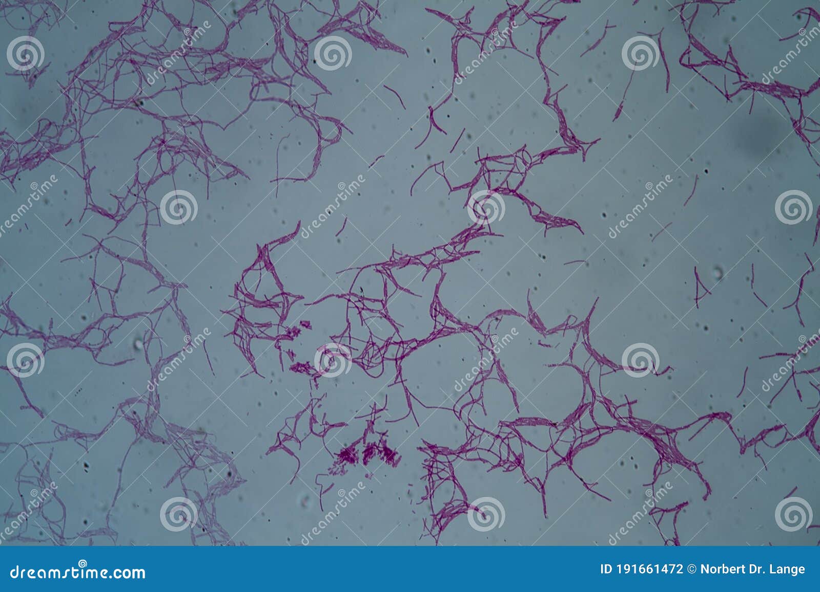 Bacillus Anthracis Anthrax 200x Stock Photo - Image of dangerous ...