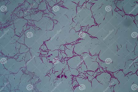Bacillus Anthracis Anthrax 200x Stock Photo - Image of dangerous ...