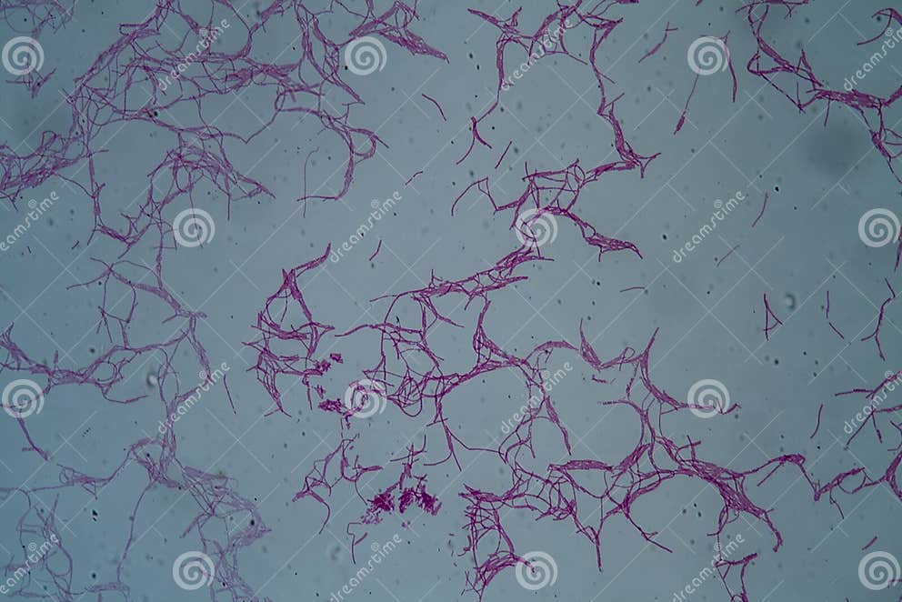 Bacillus Anthracis Anthrax 200x Stock Photo - Image of dangerous ...
