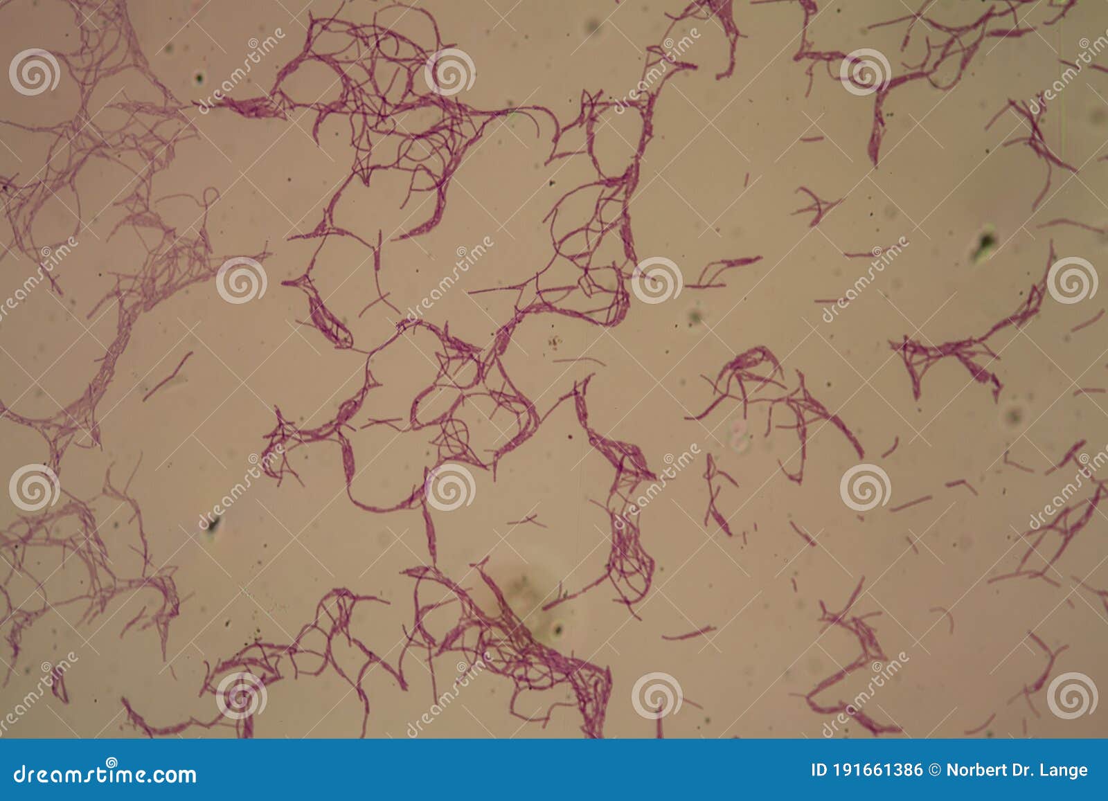 Bacillus Anthracis Antrace 200 X Fotografia Stock - Immagine di ...