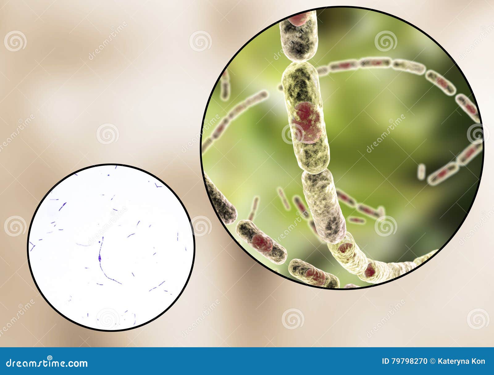 Bacillus Anthracis, Light Micrograph and Illustration Stock ...