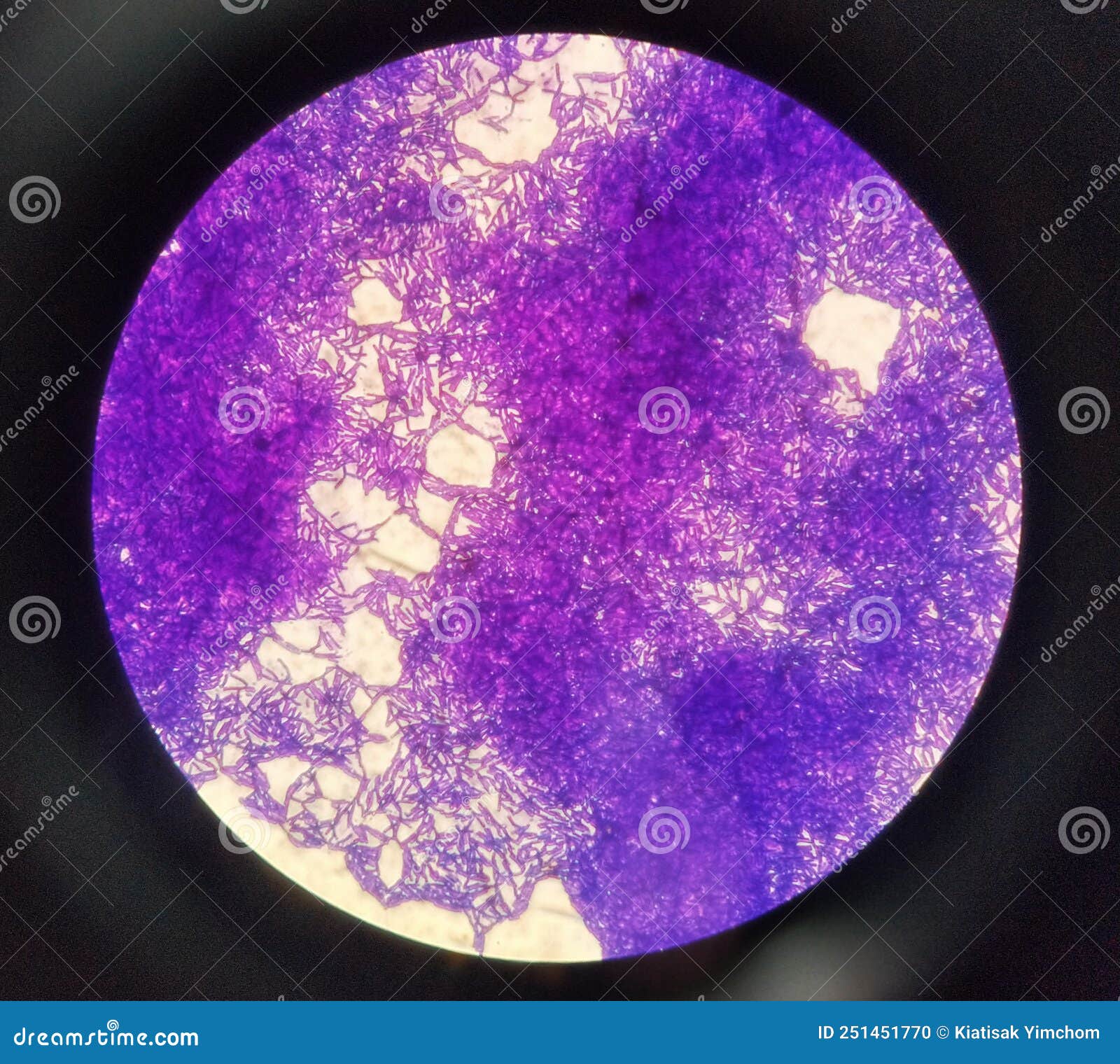 Bacillus cereus foto de archivo. Imagen de violeta, foto - 251451770