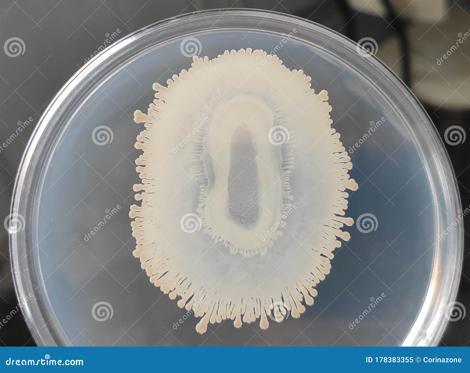 Bacillus Genus Bacteria Growing from a Sample Stock Image - Image of ...