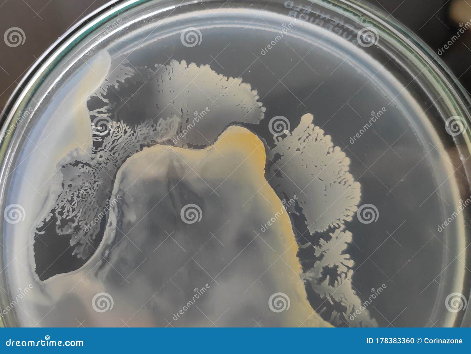 The Beautiful Art Of Bacteria - Microscope View Of Bacillus And Other ...