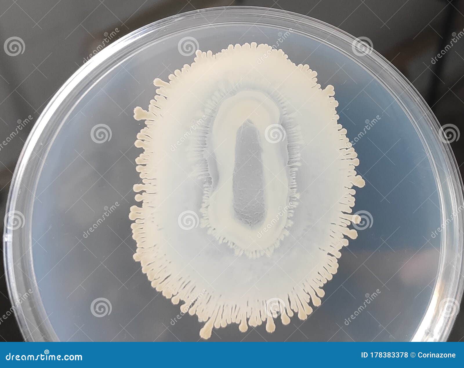 Bacillus Genus Bacteria Growing from a Sample Stock Photo - Image of ...