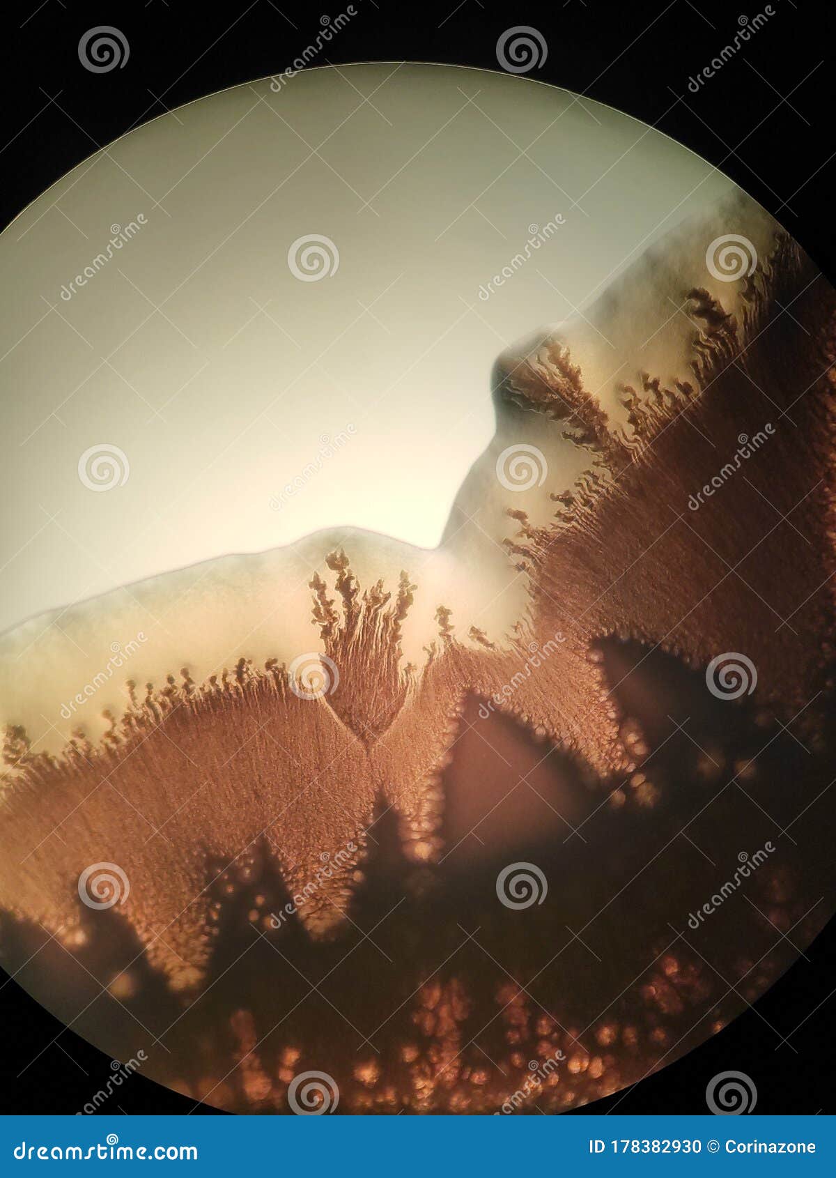 Bacicclus Genus Bacteria Growing in Round Shaped Colonies Stock Photo ...