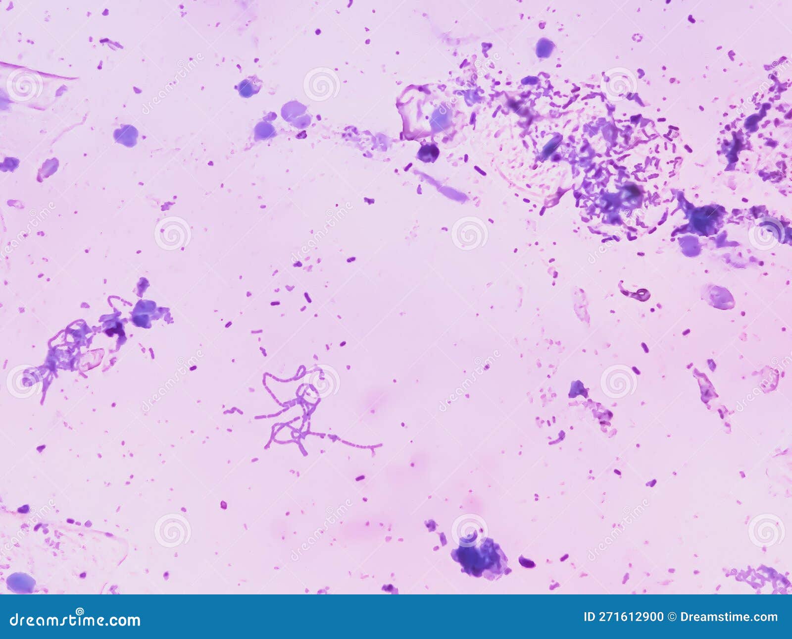 Bacillus Megatherium Microscopic Gram Kleuring Stock Foto - Image of ...