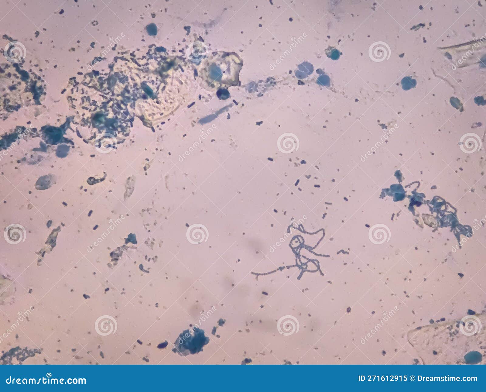 Bacillus Megatherium Microscopic Gram Staining Stock Image - Image of ...