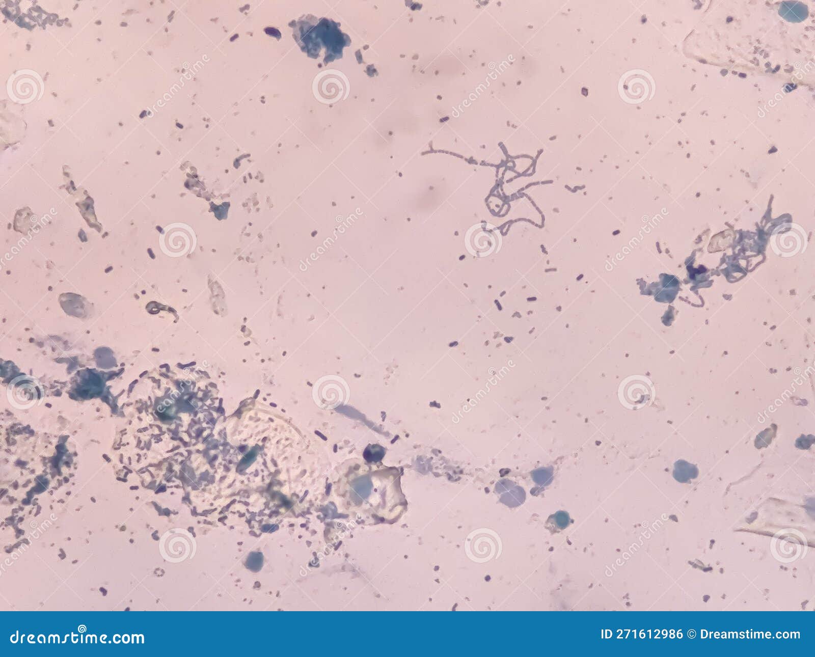 Bacillus Gram Positive Stain Under Microscope View. Bacillus Is Rod ...