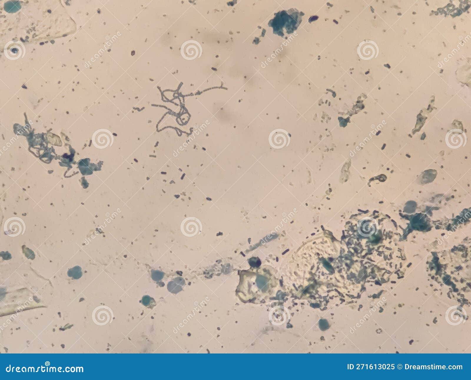 Bacillus Gram Positive Stain Under Microscope View. Bacillus Is Rod ...