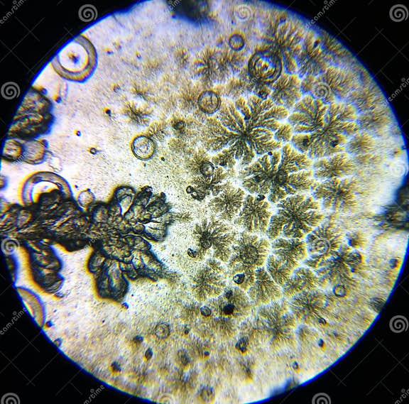 Bacillus Subtilis Beautiful Bacterial Growth Under the Microscope Stock ...