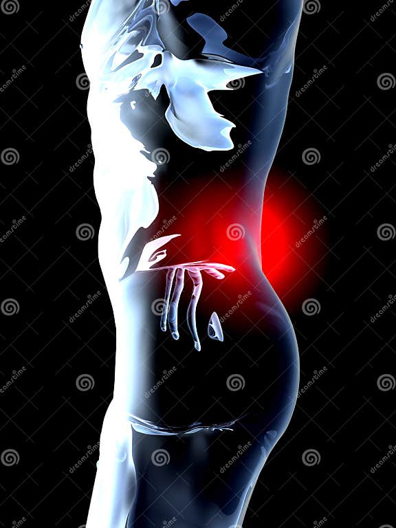 Back Ache - Anatomy stock illustration. Illustration of inflammation ...