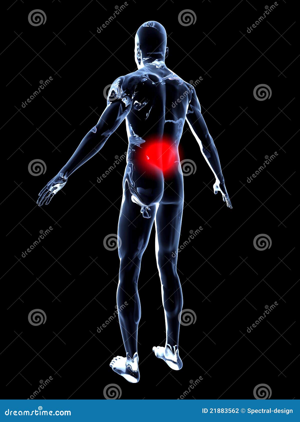 Back Ache - Anatomy stock illustration. Illustration of care - 21883562