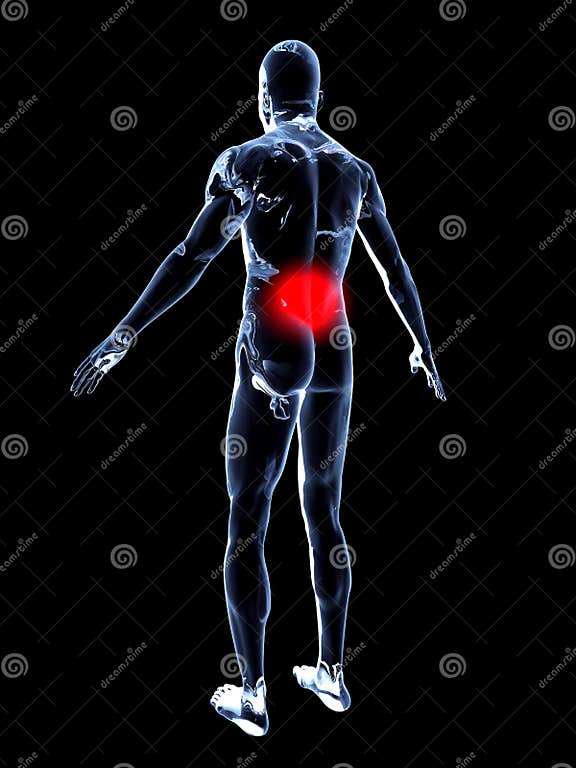 Back Ache - Anatomy stock illustration. Illustration of care - 21883562