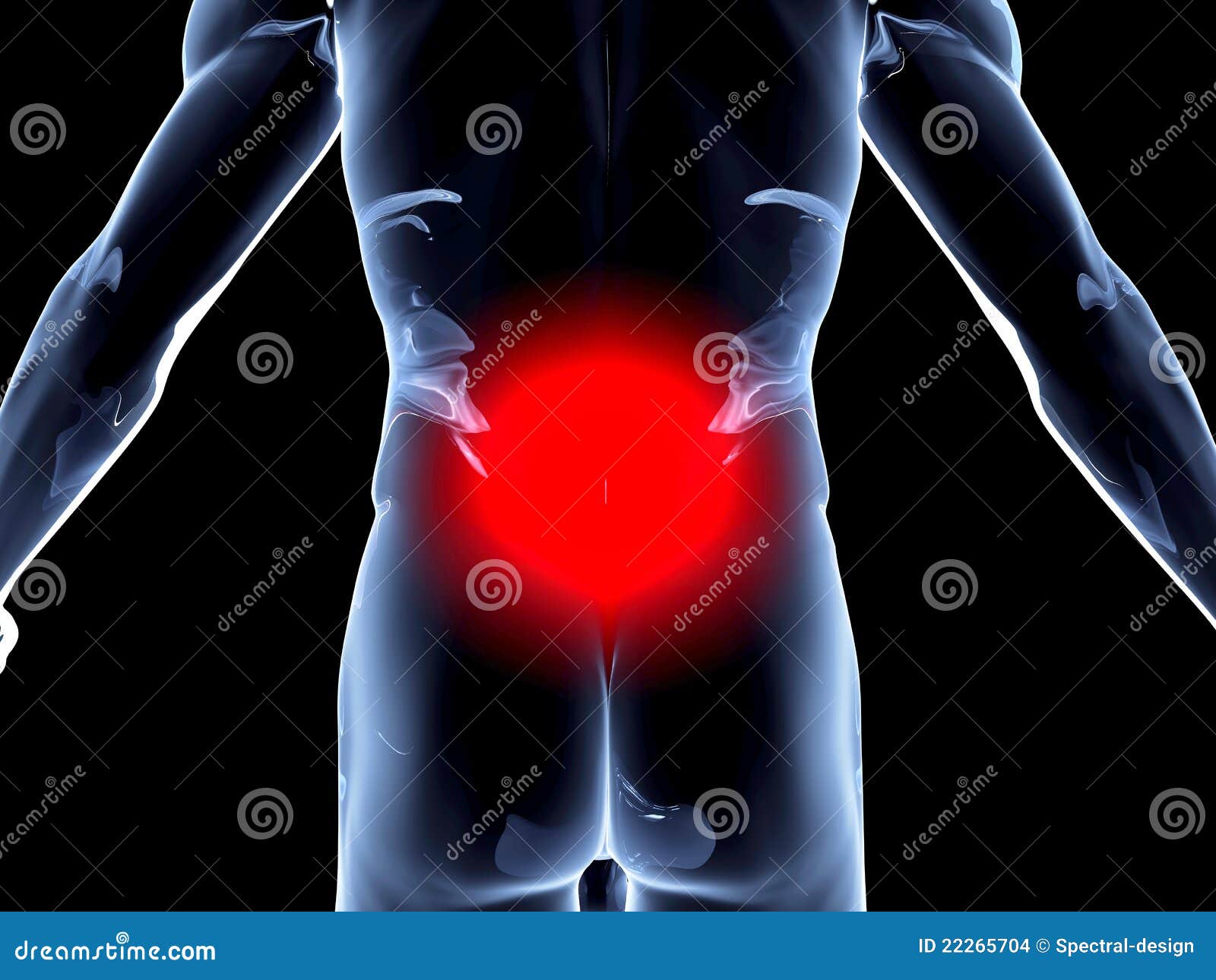 Back Ache - Anatomy stock illustration. Illustration of chirurgic ...