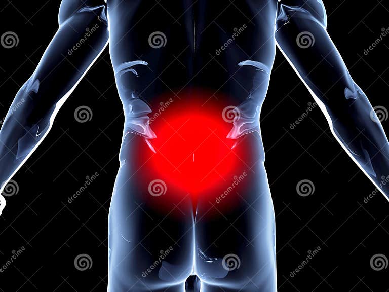 Back Ache - Anatomy stock illustration. Illustration of chirurgic ...