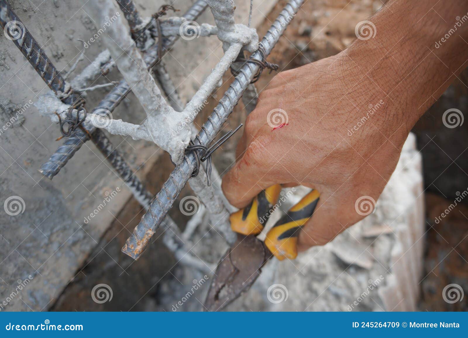 The Back of the Hand Was a Fresh Wound and Bleeding Caused by a Steel ...