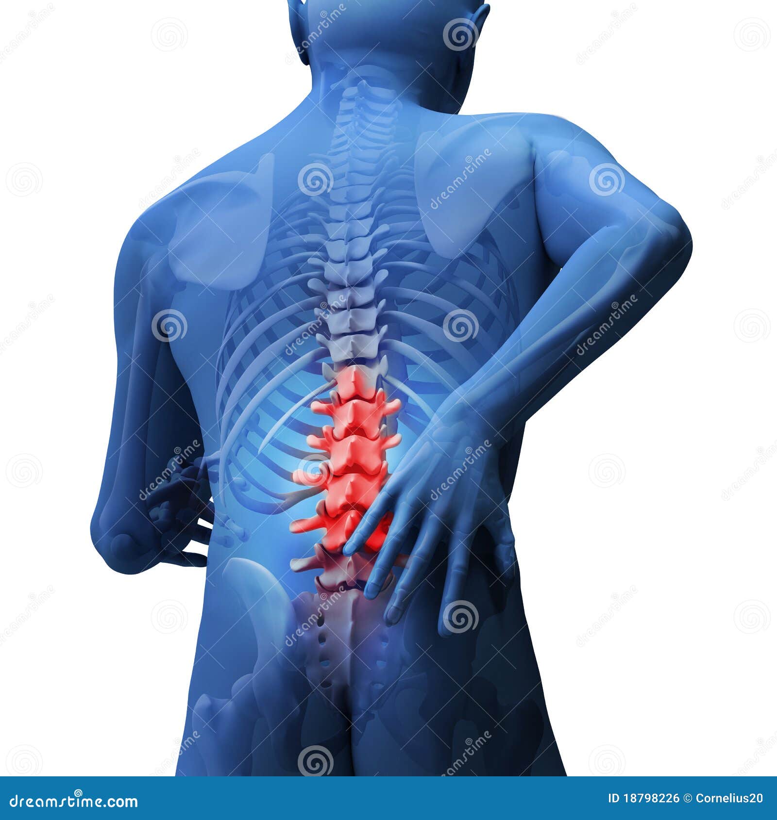 Back hurt stock illustration. Illustration of posture - 18798226