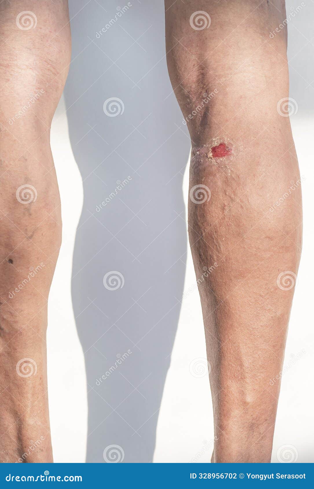 The Back of the Leg of the Old Man Standing Stock Photo - Image of ...