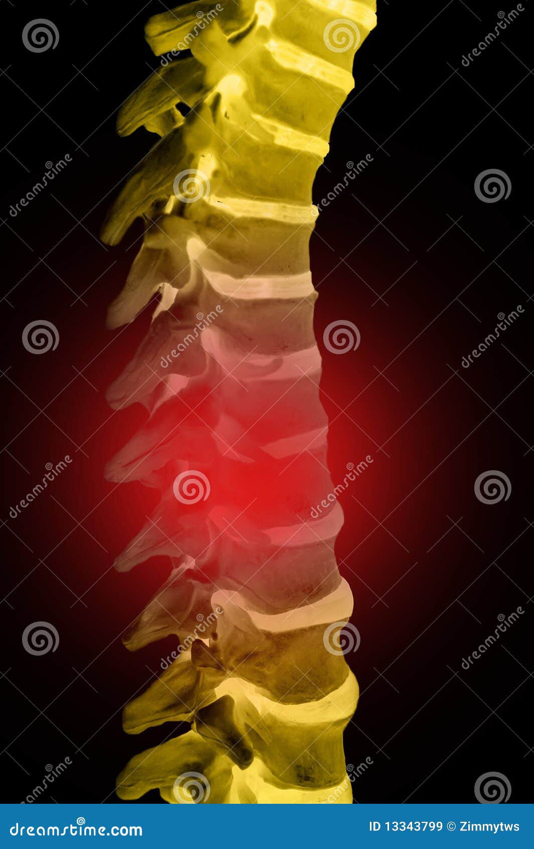 Back pain stock image. Image of spinal, system, nerve - 13343799