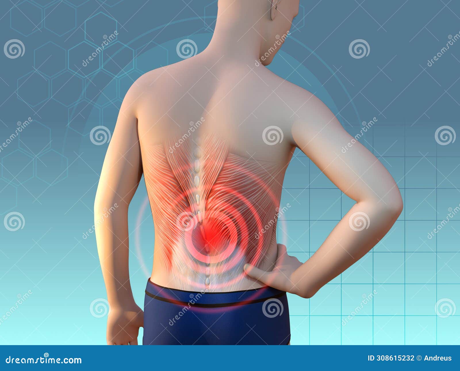 Back pain symptoms stock illustration. Illustration of body - 308615232