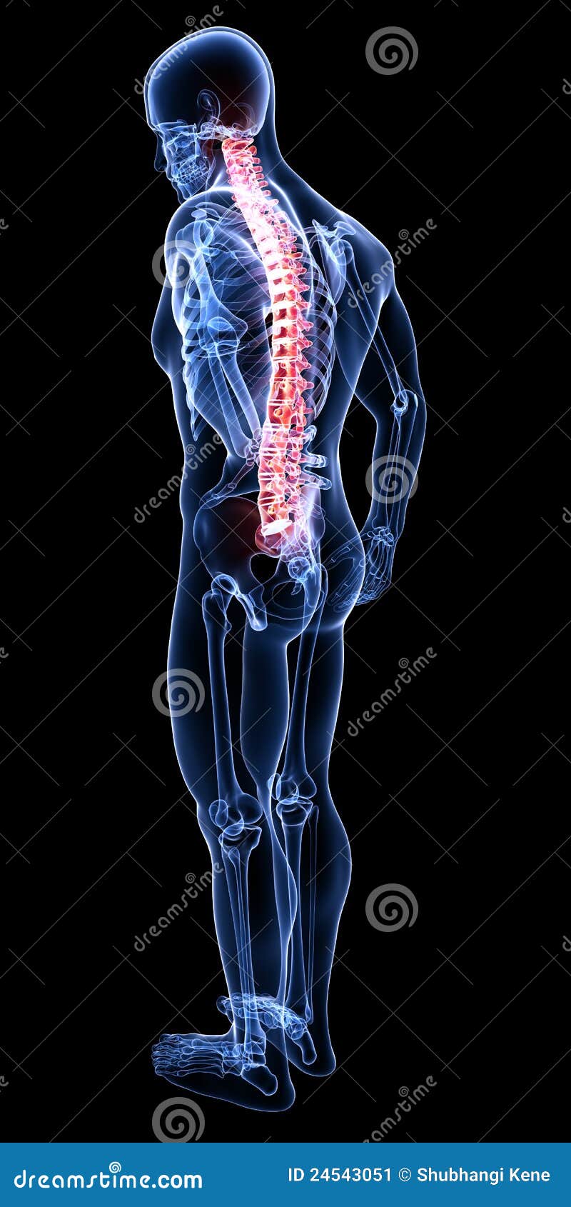 Back Pain Body Stock Illustrations – 11,707 Back Pain Body Stock ...