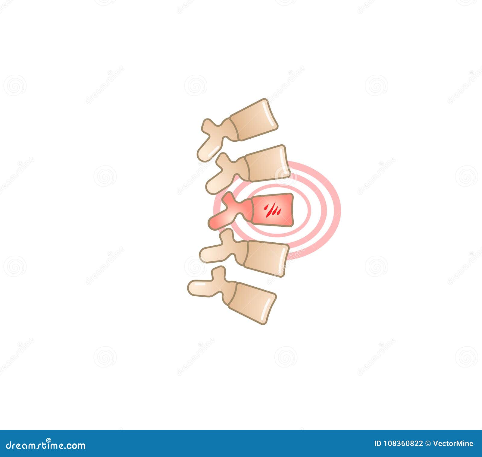 Back Pain Vector Illustration Icon Stock Vector - Illustration of logo ...