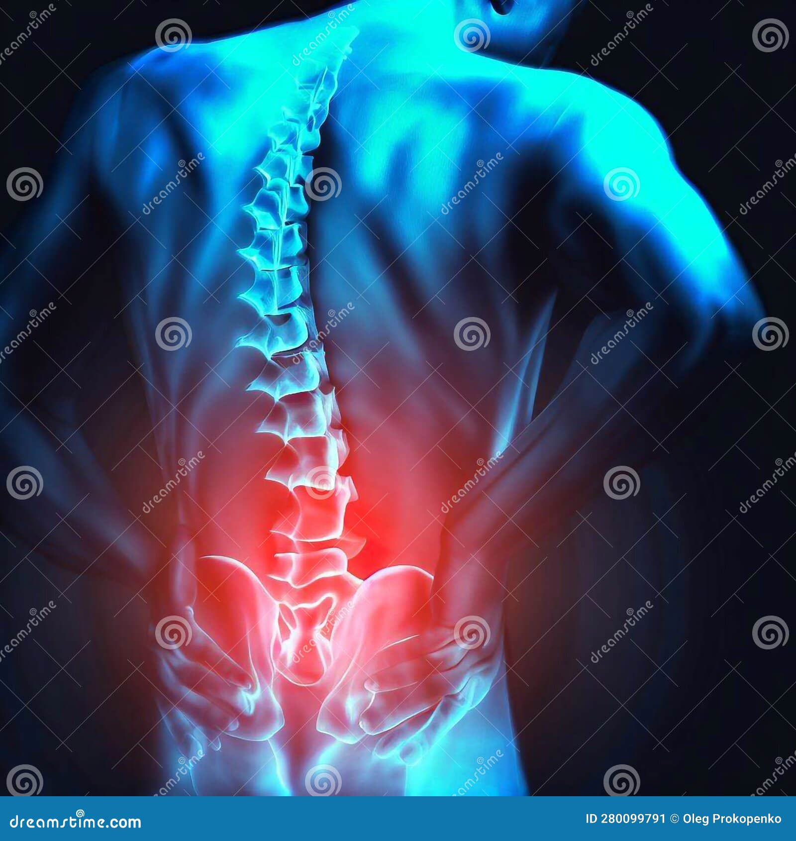 Back Problems, Pain, Sciatica, Spine Stock Illustration - Illustration ...