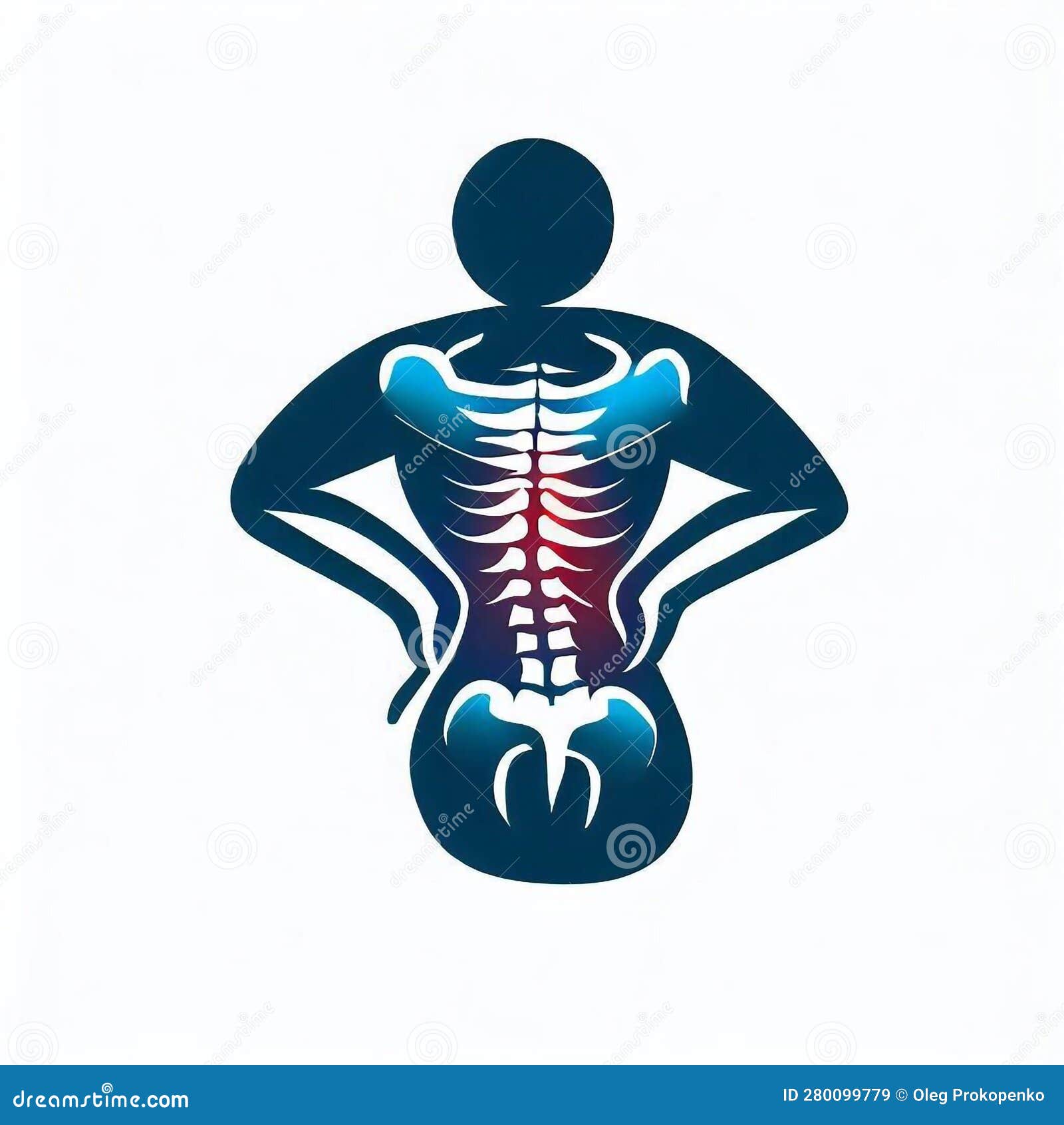 Back Problems Healthy Back Pain Slipped Disc Prolapse Cartoon Vector ...