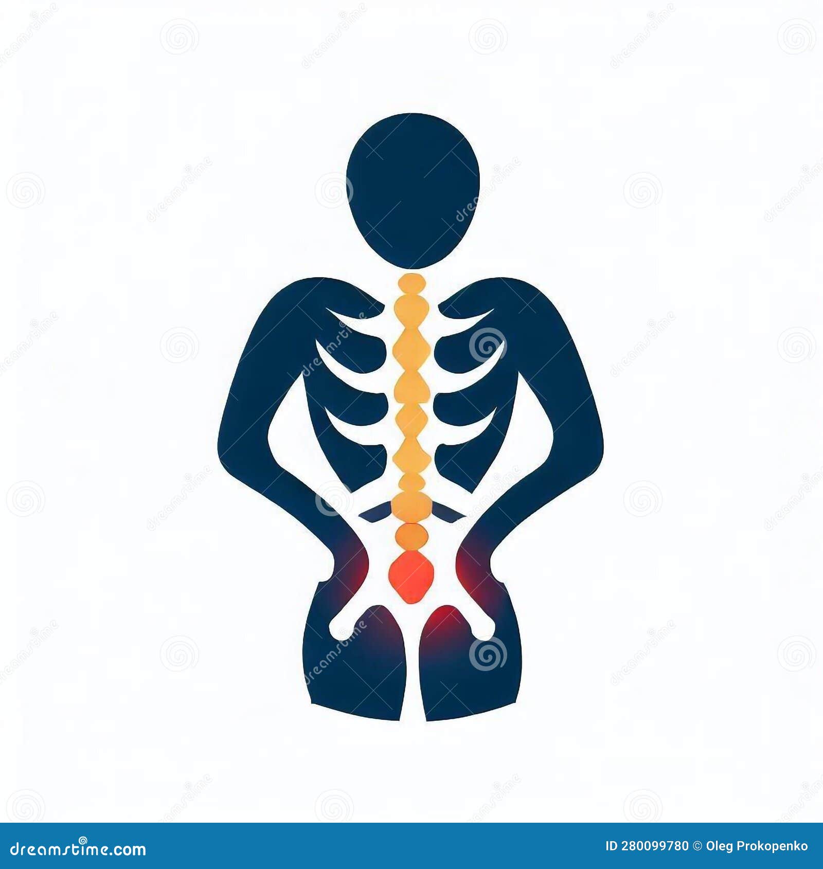 Back Problems, Pain, Sciatica, Spine Stock Illustration - Illustration ...