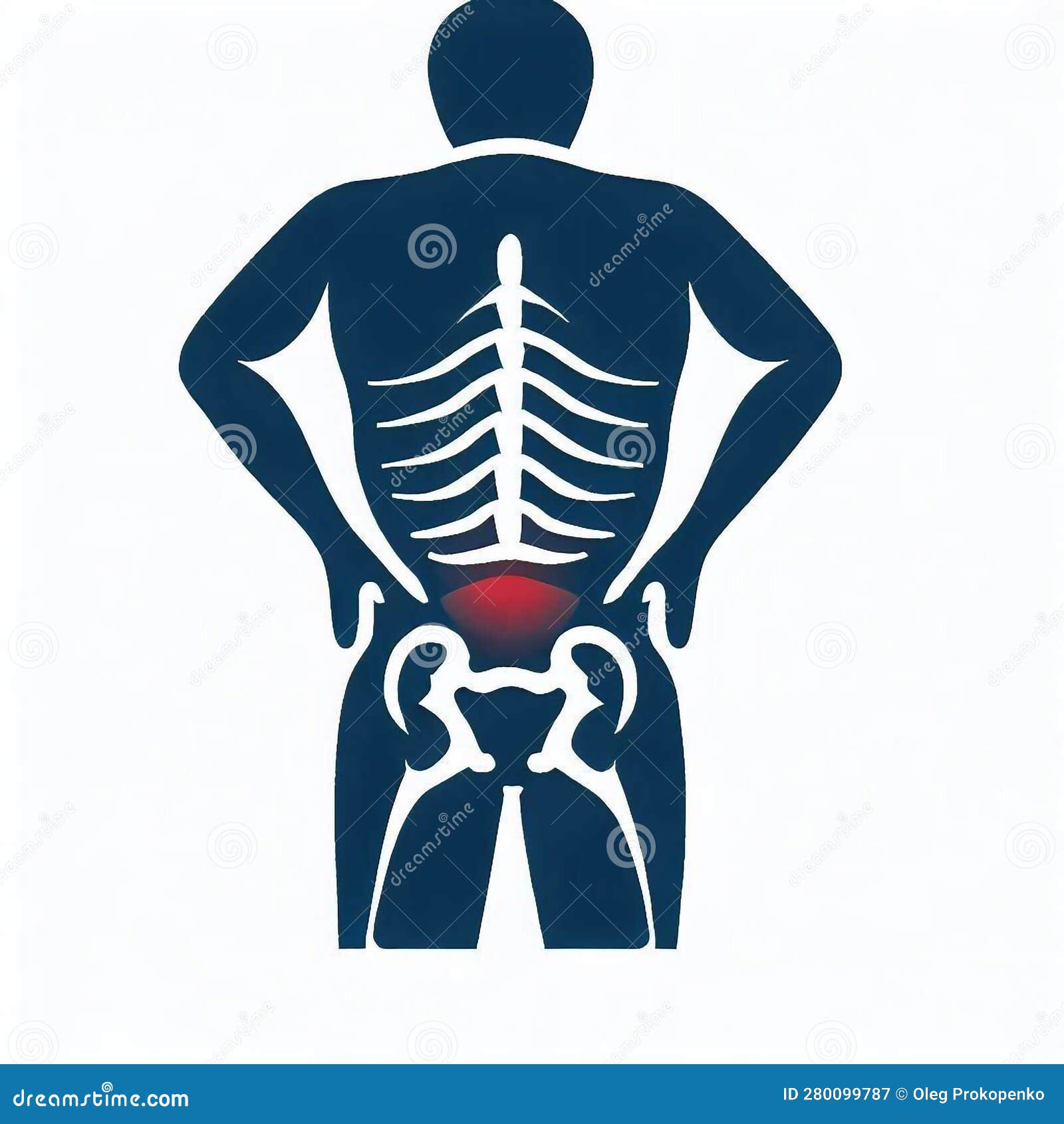 Back Problems, Pain, Sciatica, Spine Stock Illustration - Illustration ...