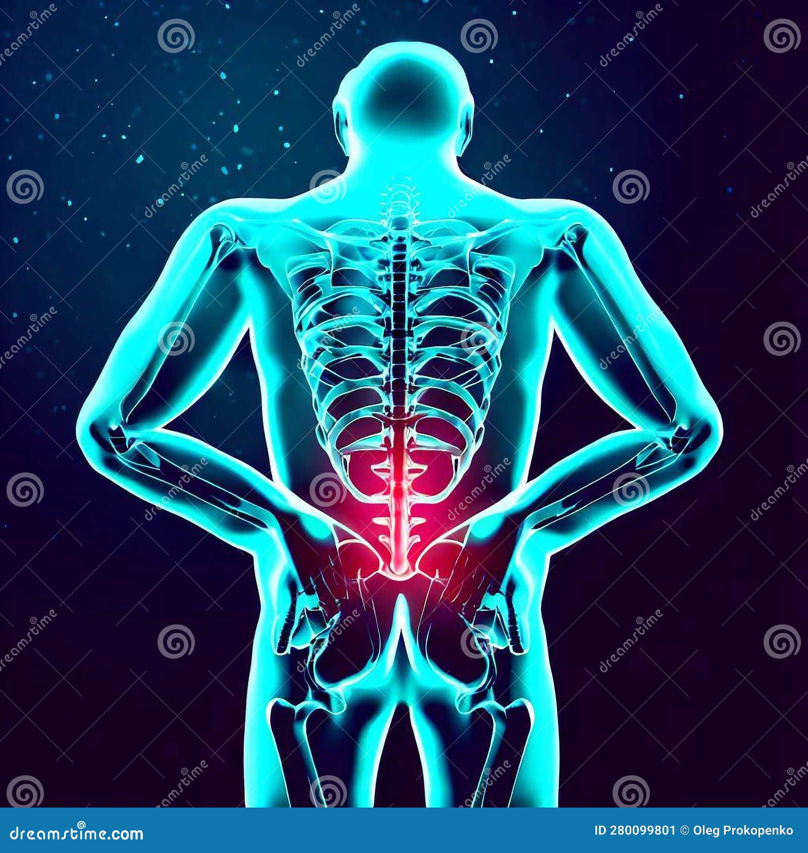 Back Problems, Pain, Sciatica, Spine Stock Illustration - Illustration ...