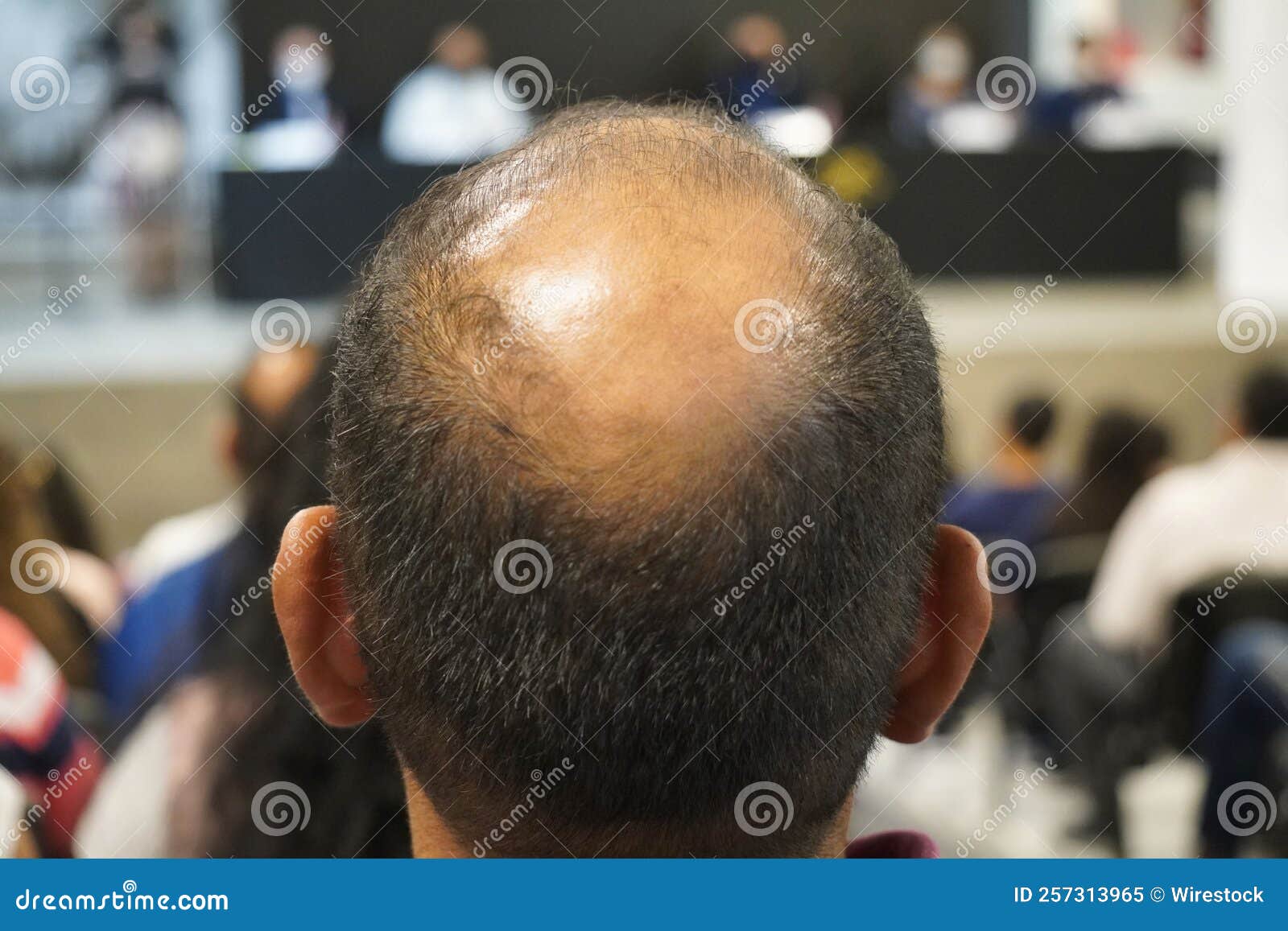 Back Shot of a Partly Bald Man Head Stock Image - Image of black, skin ...