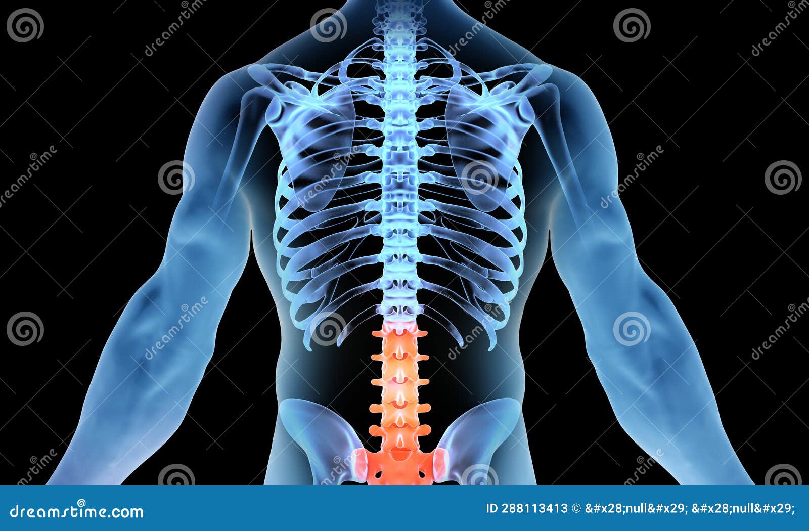 X-ray Lumbar Section of the Spine Back View with Injury Stock ...