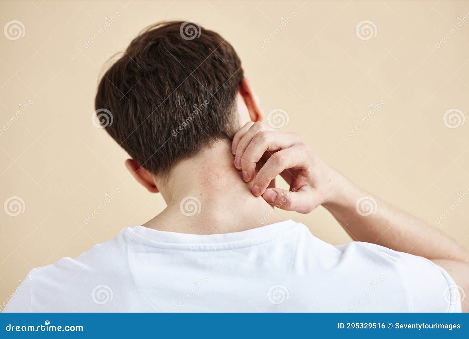 Back View of Man Scratching Neck Rash or Skin Condition Stock Photo ...