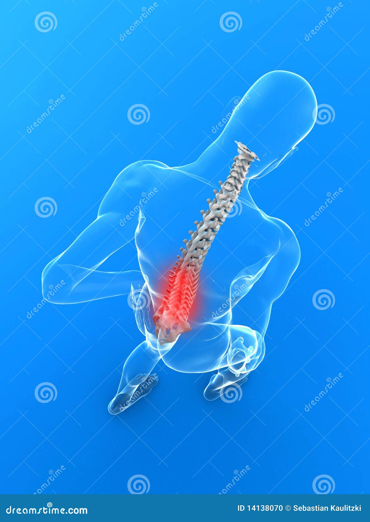 Backache stock illustration. Illustration of anatomical - 14138070