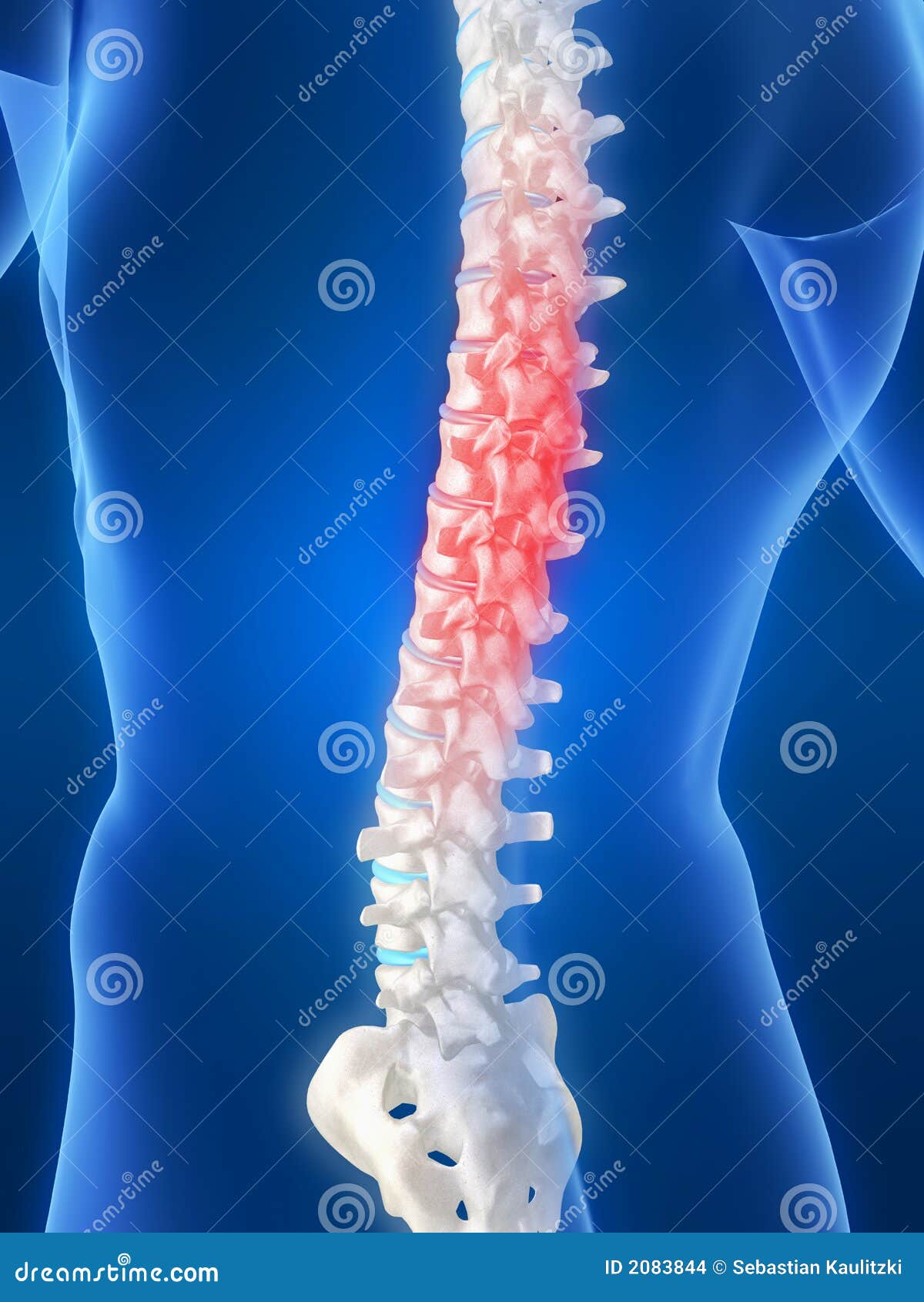 Backache stock illustration. Illustration of arthritis - 2083844