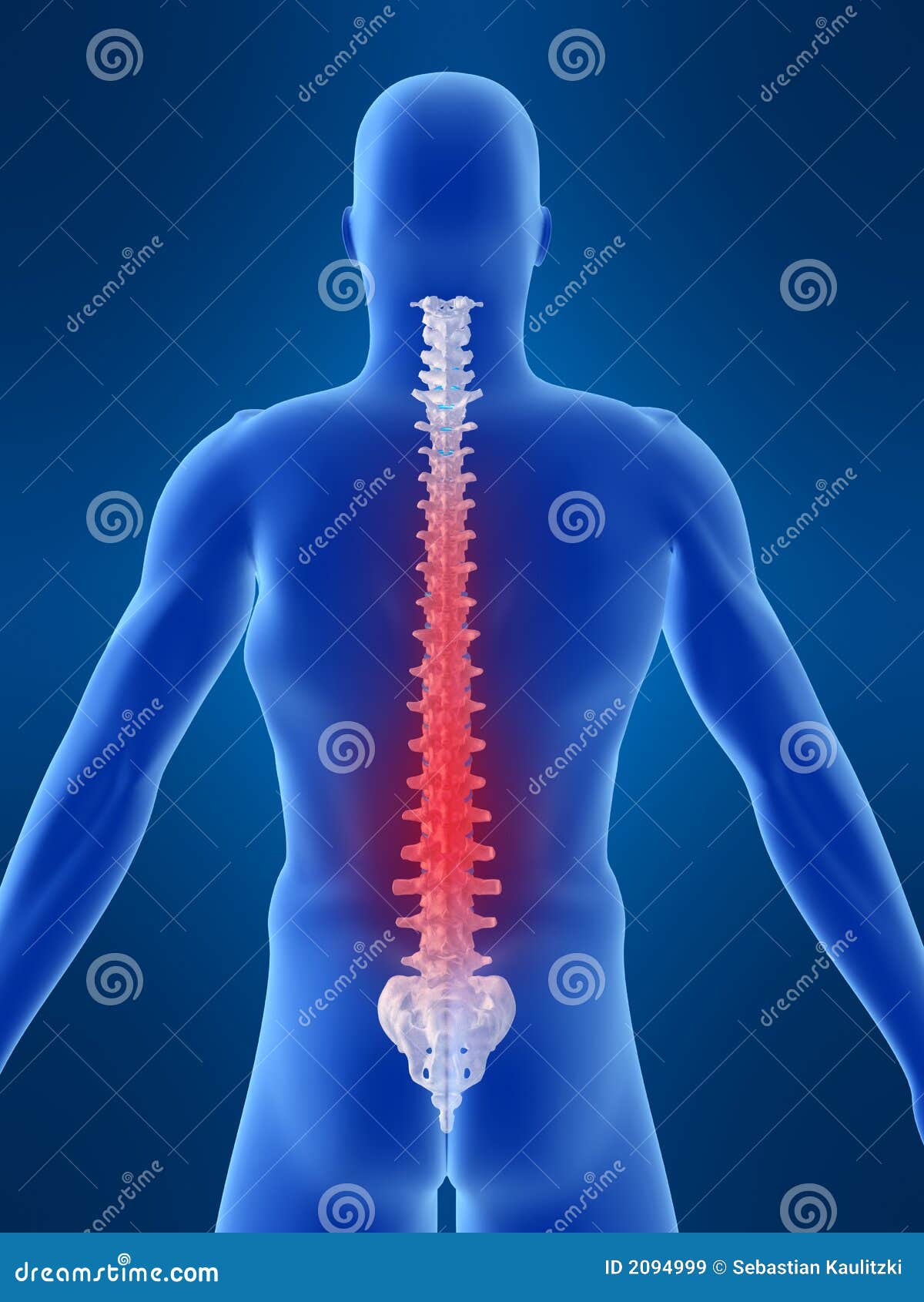 Backache stock illustration. Illustration of biology, skeletal - 2094999