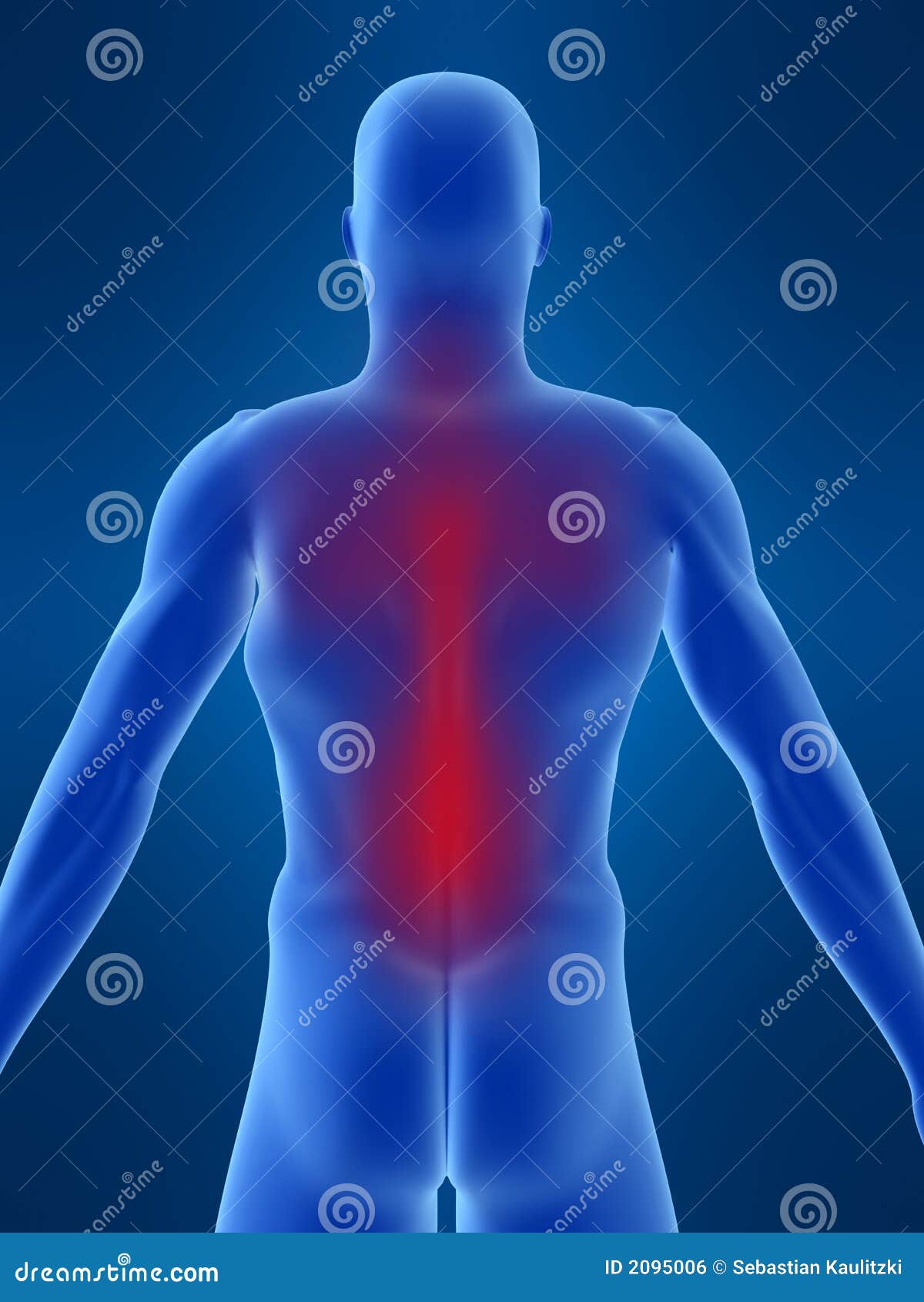 Backache stock illustration. Illustration of anatomical - 2095006