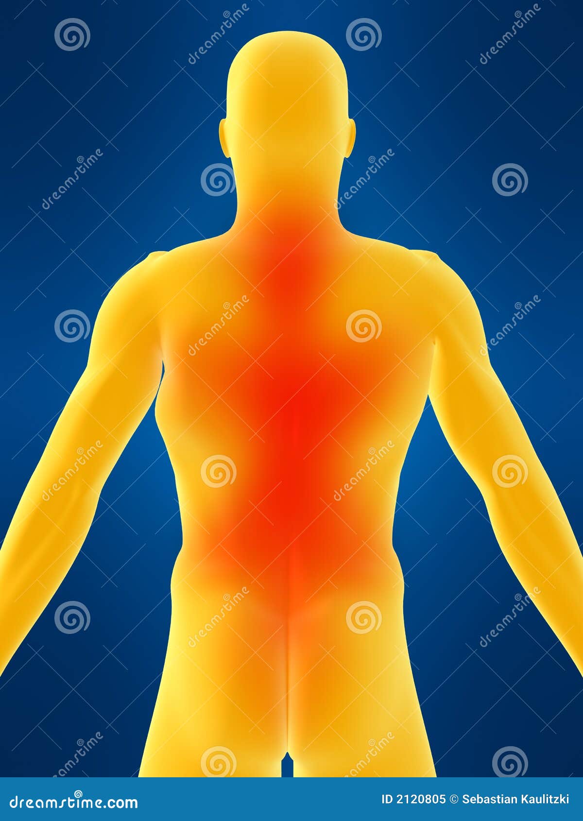 Backache stock illustration. Illustration of medical, illness - 2120805
