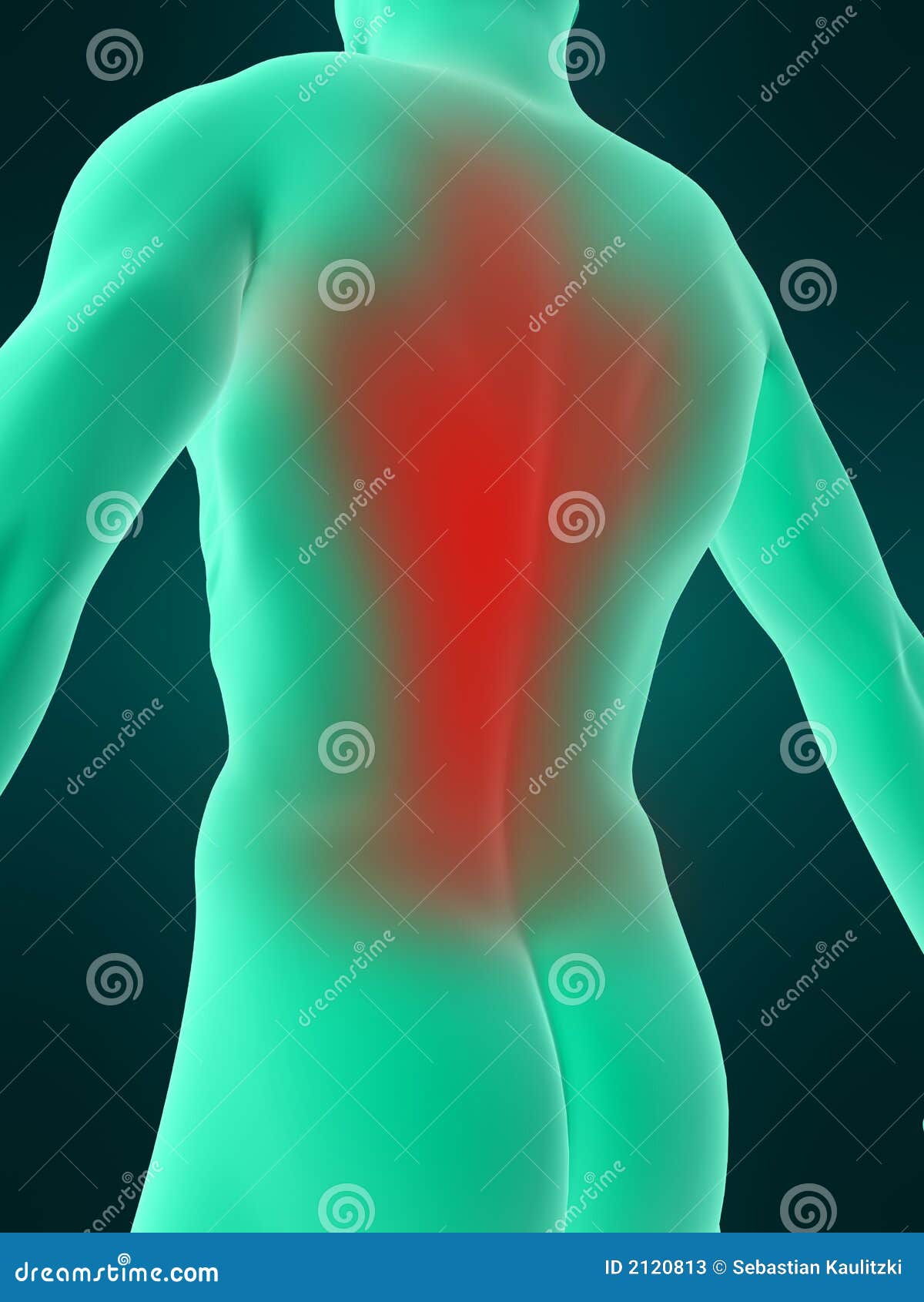 Backache stock illustration. Illustration of rheumatism - 2120813