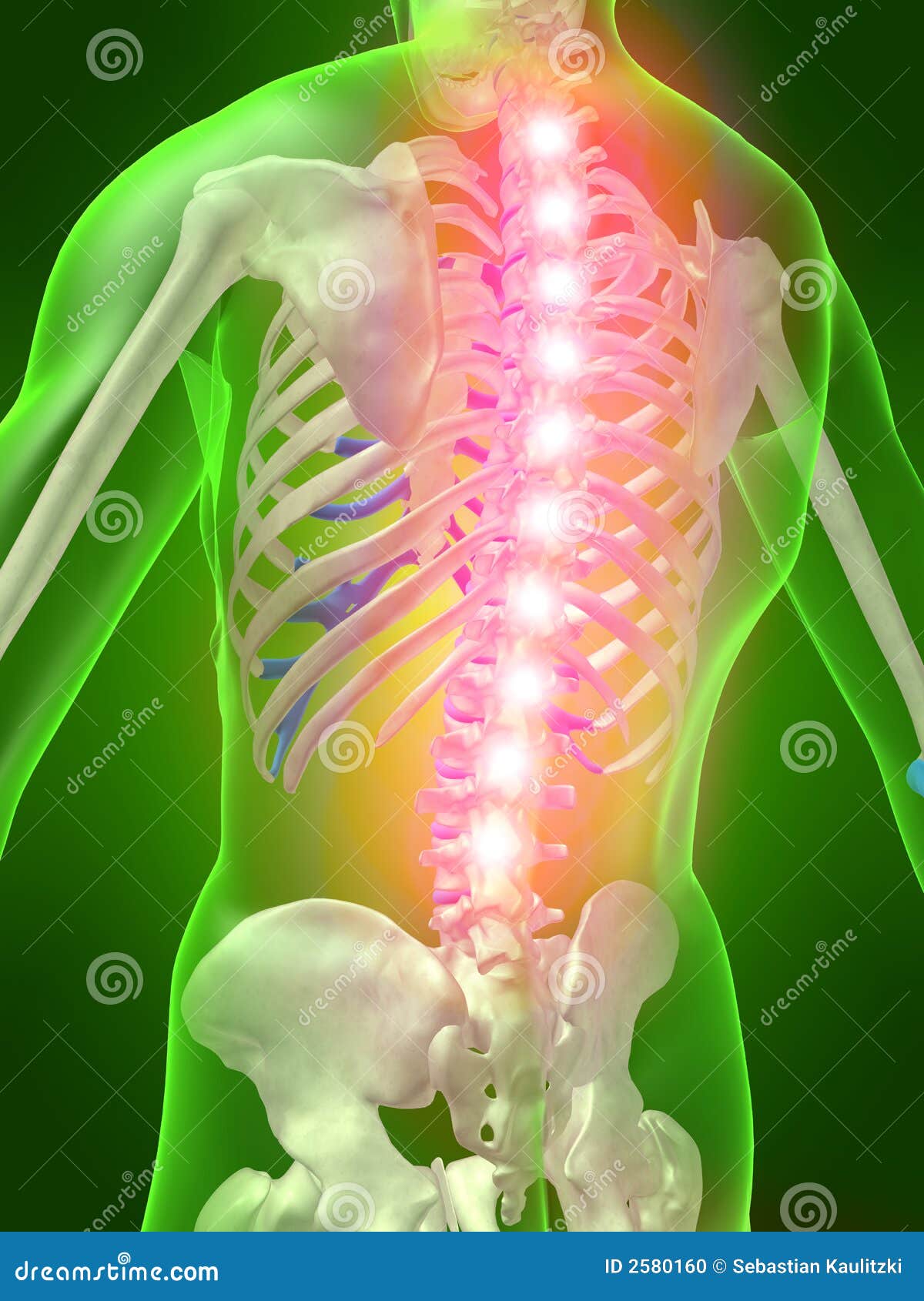 Backache stock illustration. Illustration of inflammation - 2580160